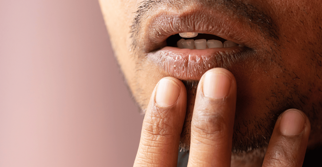 Sudah Minum Banyak Tapi Mulut Masih Kering? - Ecommerce Layanan Kesehatan