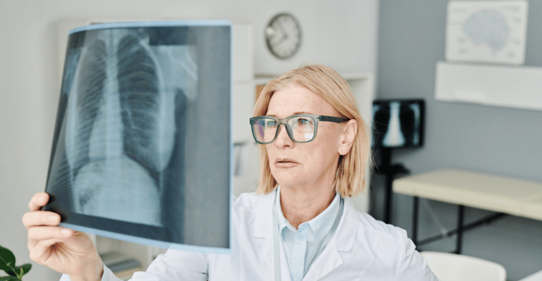 Hasil Rontgen Thorax yang Bagus - Ecommerce Layanan Kesehatan