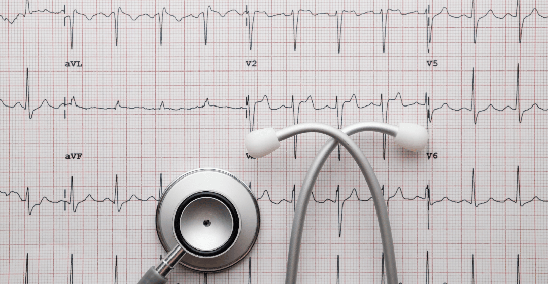 Fungsi Pemeriksaan EKG - Gmeds Medical Check Up